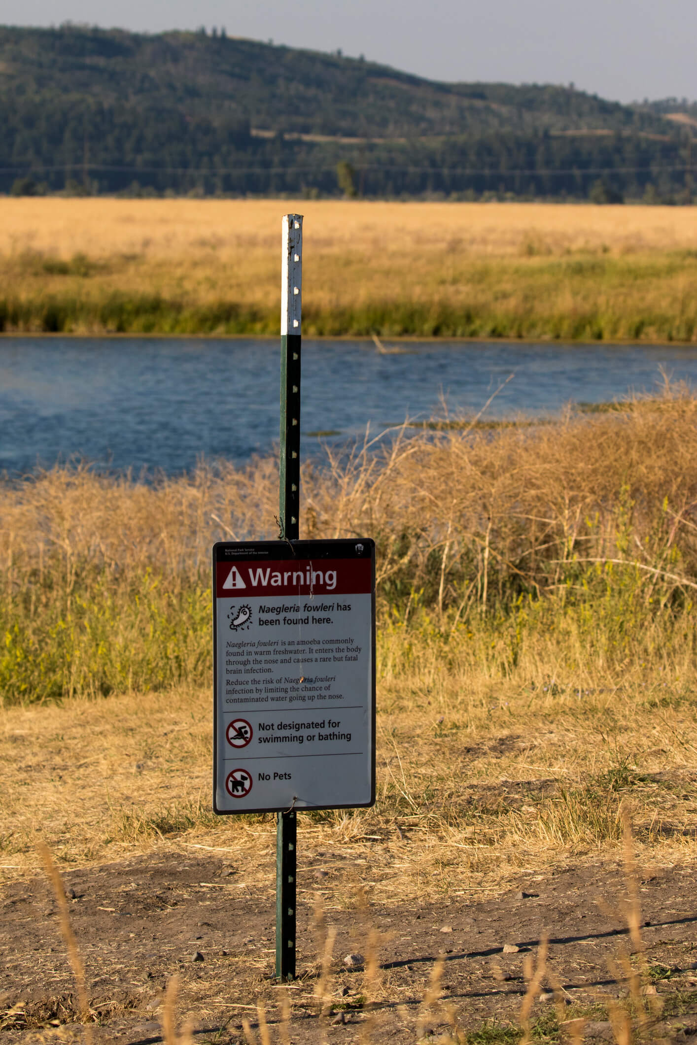 The Fight Against the Brain-Eating Amoeba | Biomedical Odyssey